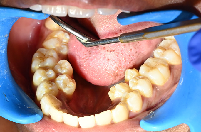 Una madre india bate el récord mundial al tener el mayor número de ...