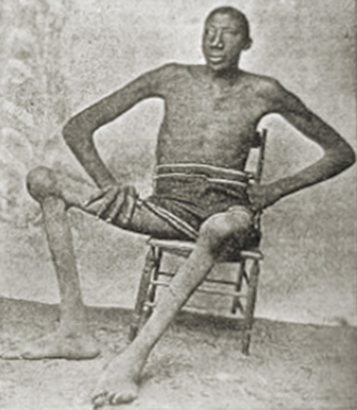 El segundo hombre más alto de la historia: John "Bud" Rogan | Guinness ...